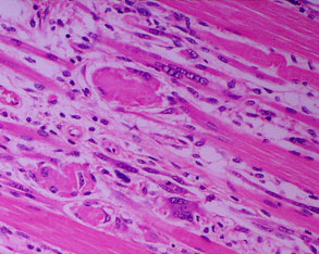 Muscle & Joint Pathology