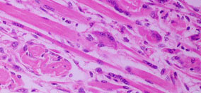 Muscle & Joint Pathology