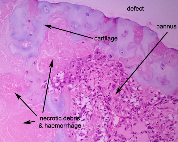 Muscle & Joint Pathology