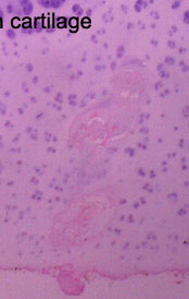 Muscle & Joint Pathology